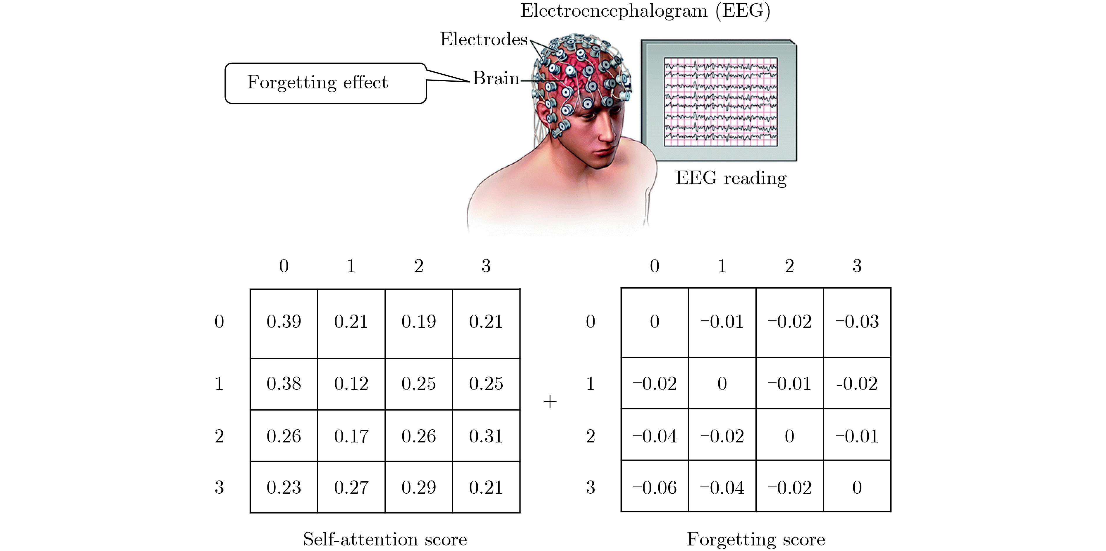 融合记忆力和自注意力机制的脑电图情绪识别模型